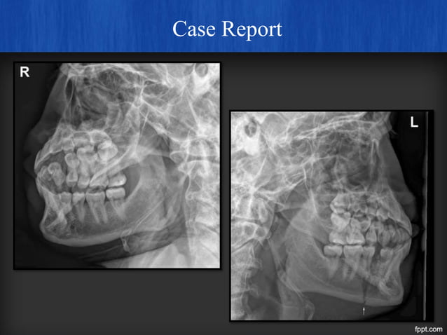Extra oral radiographic techniques | PPTX | Dental Health | Diseases ...
