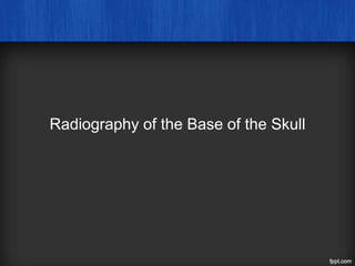Extra oral radiographic techniques | PPTX