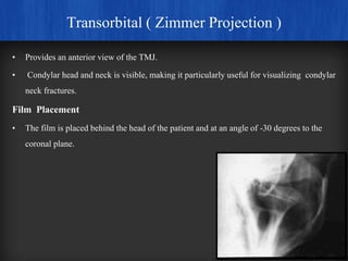 Extra oral radiographic techniques | PPTX