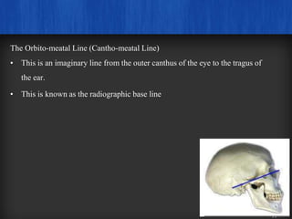 Extra oral radiographic techniques | PPTX