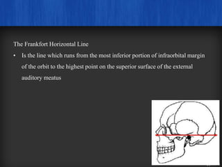 Extra oral radiographic techniques | PPTX