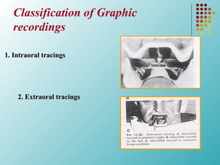extra and intra oral traces.ppt PROSTHODONTICS | PPT