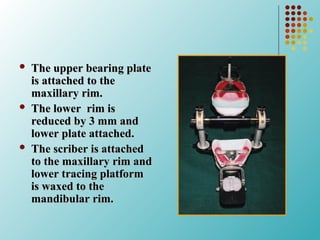 extra and intra oral traces.ppt PROSTHODONTICS | PPT
