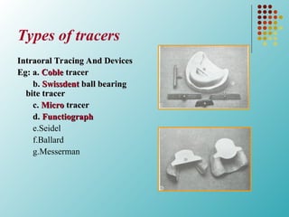 extra and intra oral traces.ppt PROSTHODONTICS | PPT