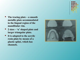 extra and intra oral traces.ppt PROSTHODONTICS | PPT