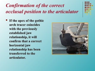 extra and intra oral traces.ppt PROSTHODONTICS | PPT