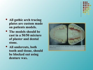 extra and intra oral traces.ppt PROSTHODONTICS | PPT