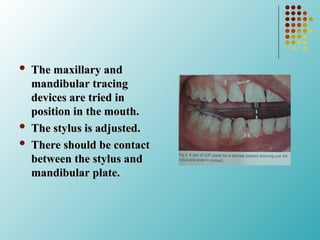 extra and intra oral traces.ppt PROSTHODONTICS | PPT