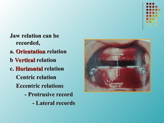 extra and intra oral traces.ppt PROSTHODONTICS | PPT