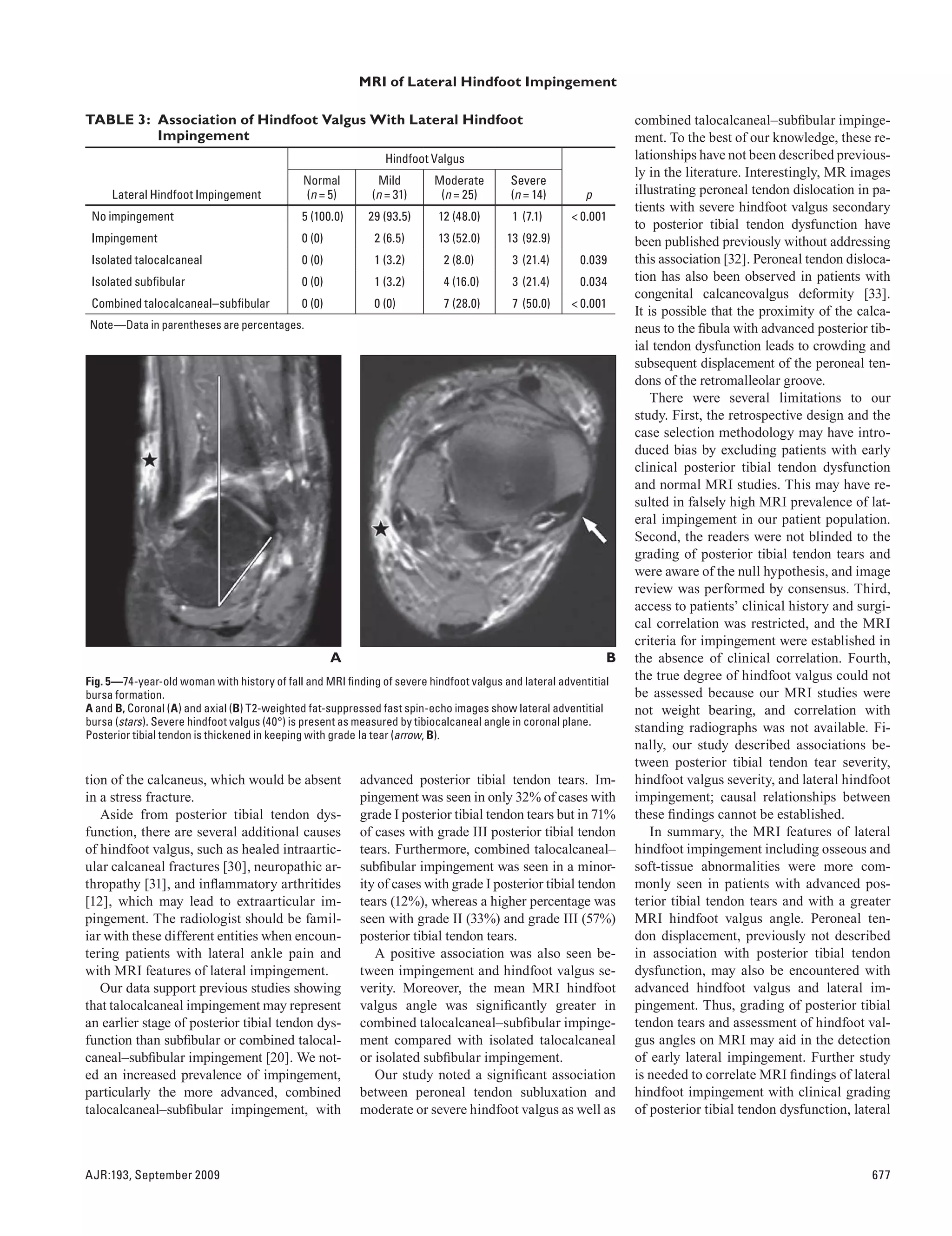 Extraarticular later hindfoot impingement with ptt tear mri correlation ...