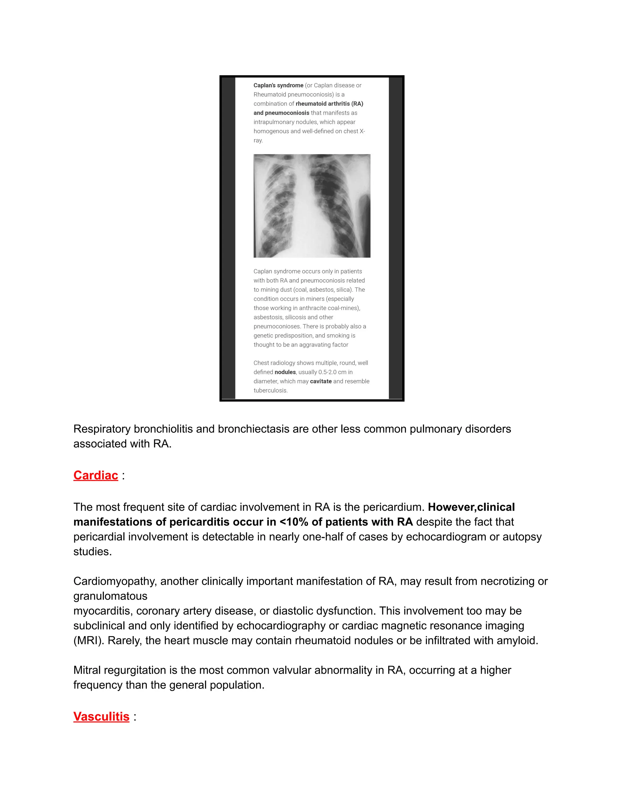 Extra articular manifestations of RA.pdf