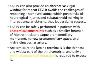 Journal Club - Extra axial Endoscopic Third Ventriculostomy.pptx