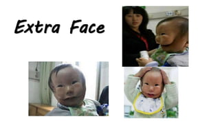 Extra bodyparts | PPTX