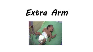 Extra bodyparts | PPTX