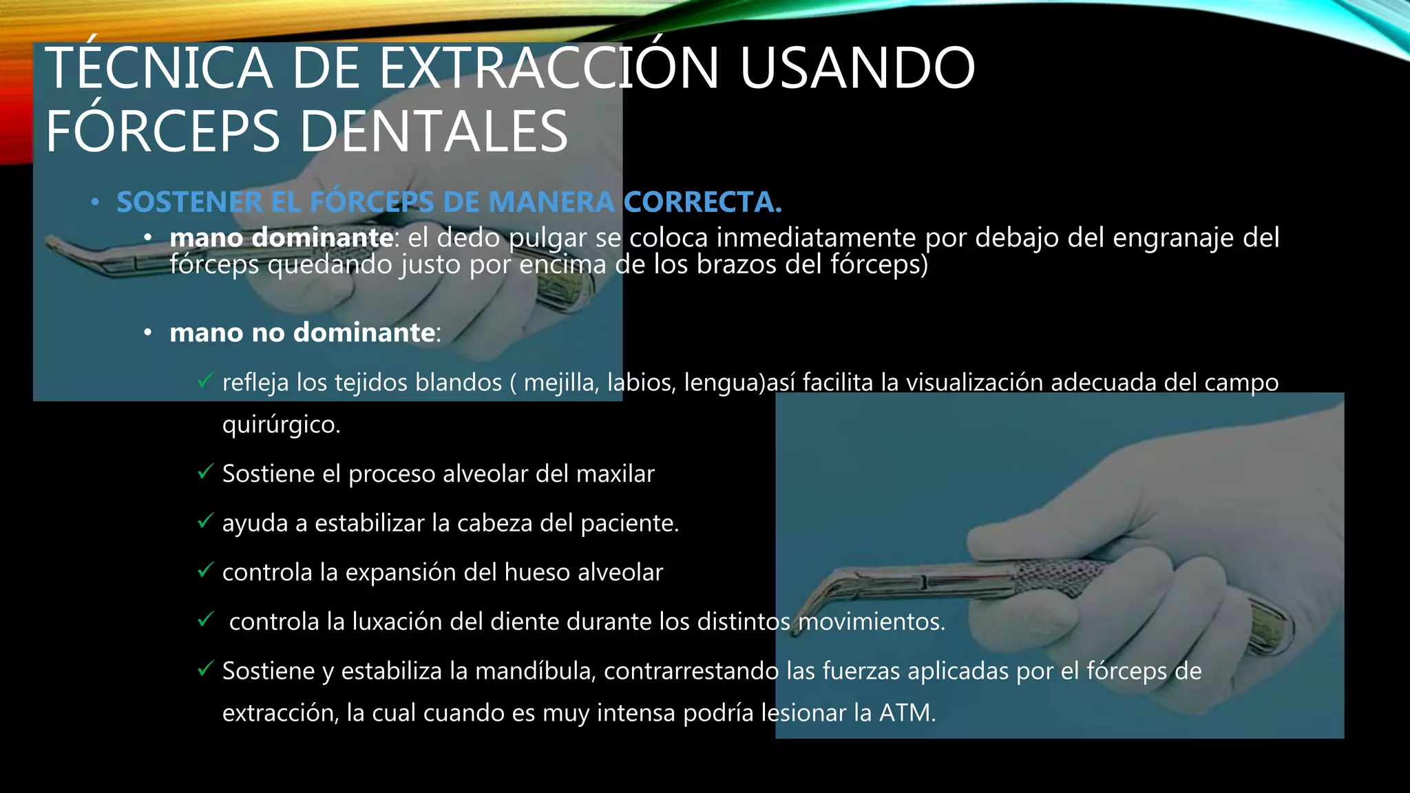 EXTRACCIÓN DENTAL SIMPLE | PPTX