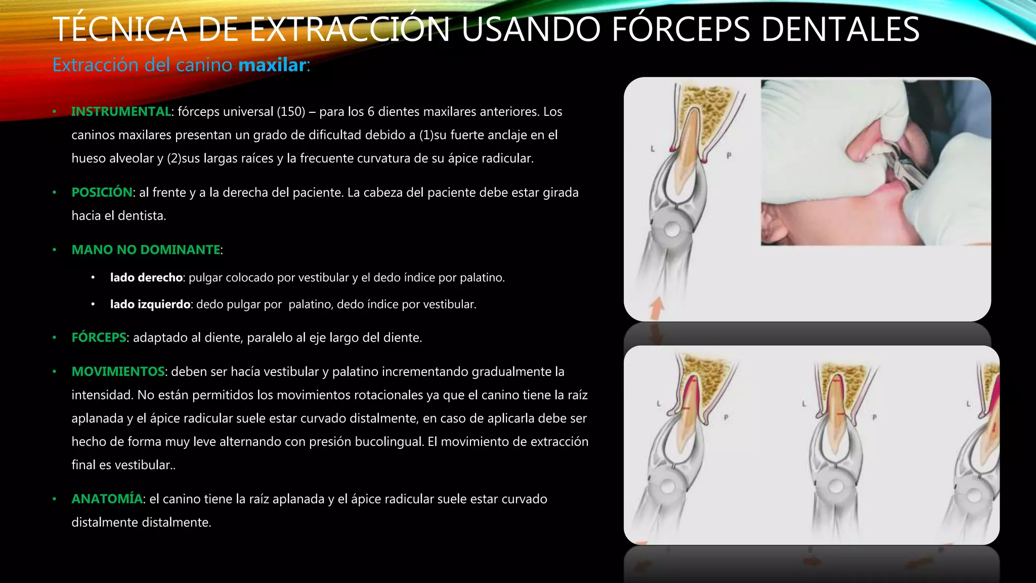 EXTRACCIÓN DENTAL SIMPLE | PPTX
