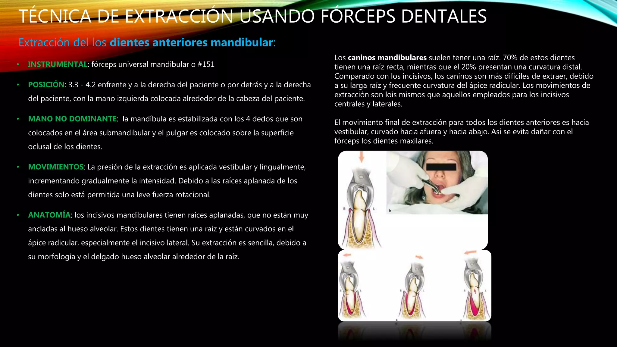 EXTRACCIÓN DENTAL SIMPLE | PPTX