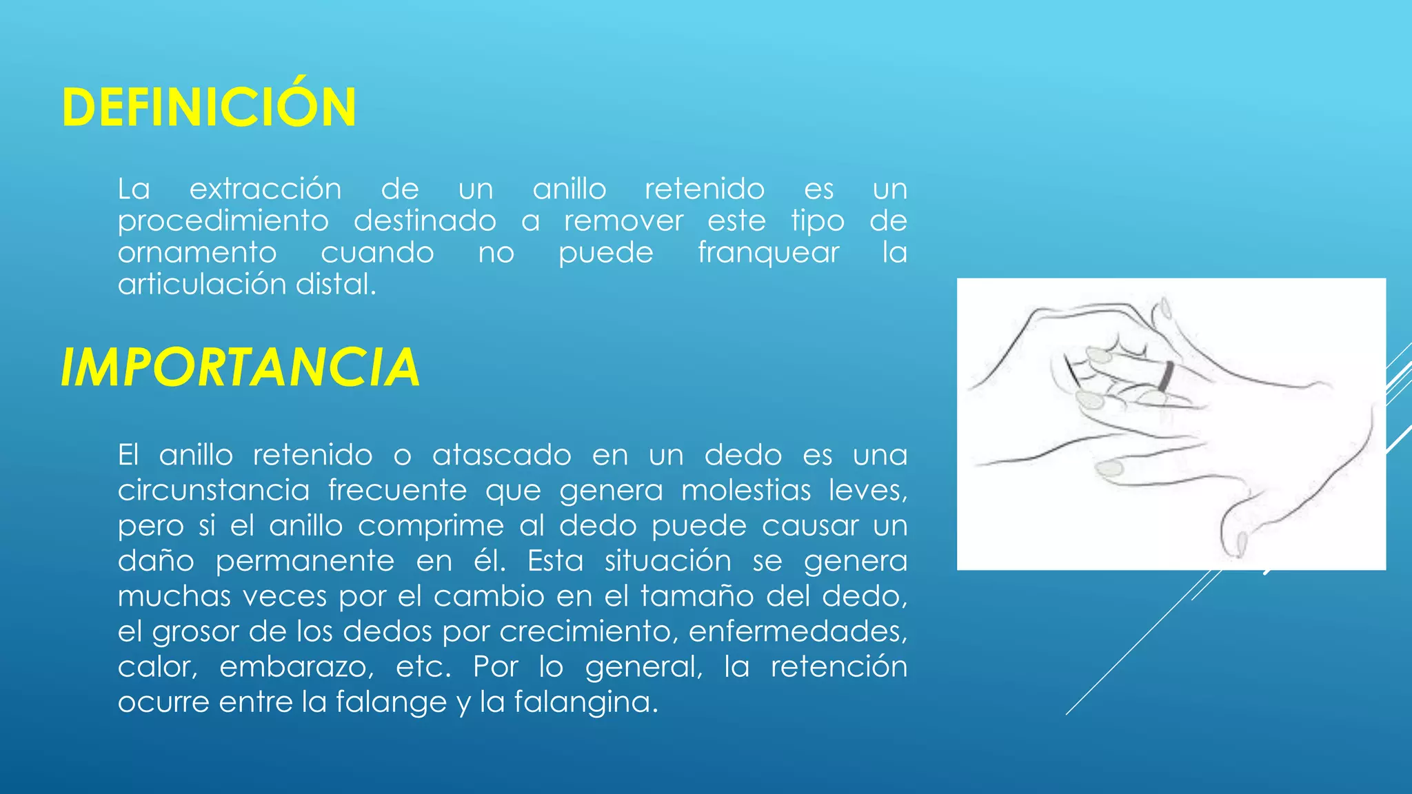Extraccion de anillos1 | PPT
