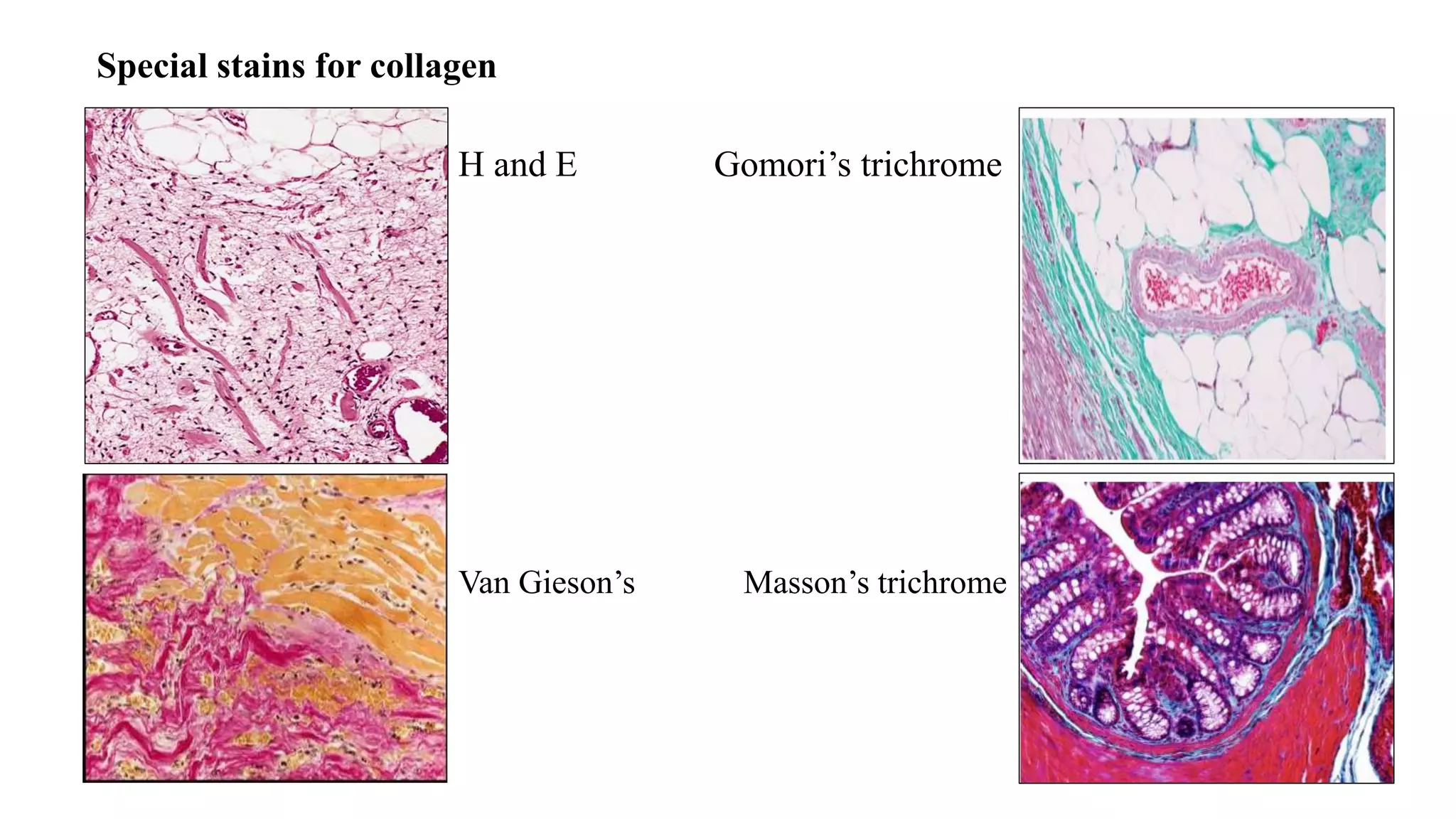 Extracellular matrix | PPT