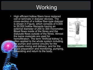 Extra Corporal Devices | PPT