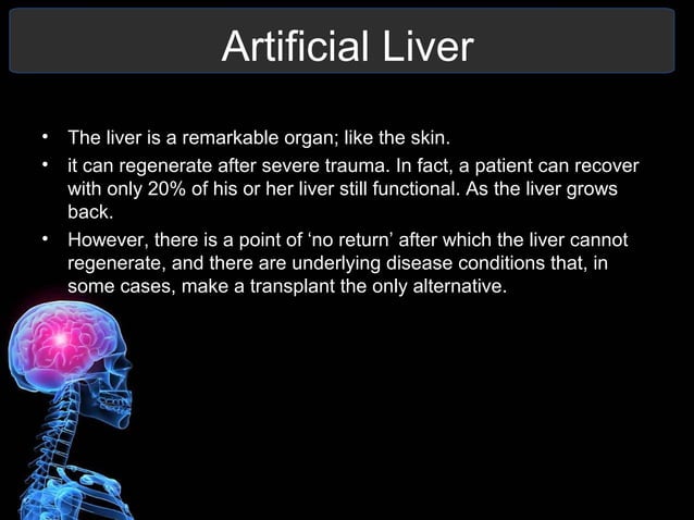 Extra Corporal Devices | PPT | Blood Disorders | Diseases and Conditions
