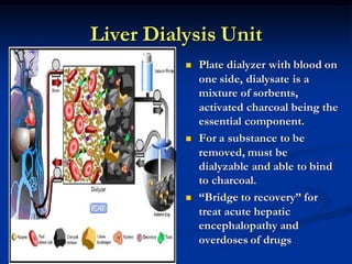 Extracorporeal liver support therapies | PDF