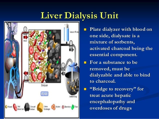 Extracorporeal liver support therapies