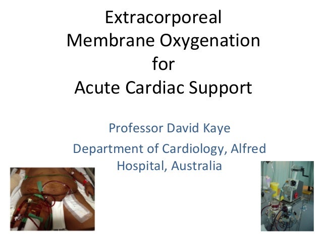 Extracorporeal membrane oxygenation.