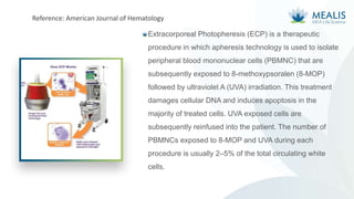 Extracorporeal Photochemotherapy