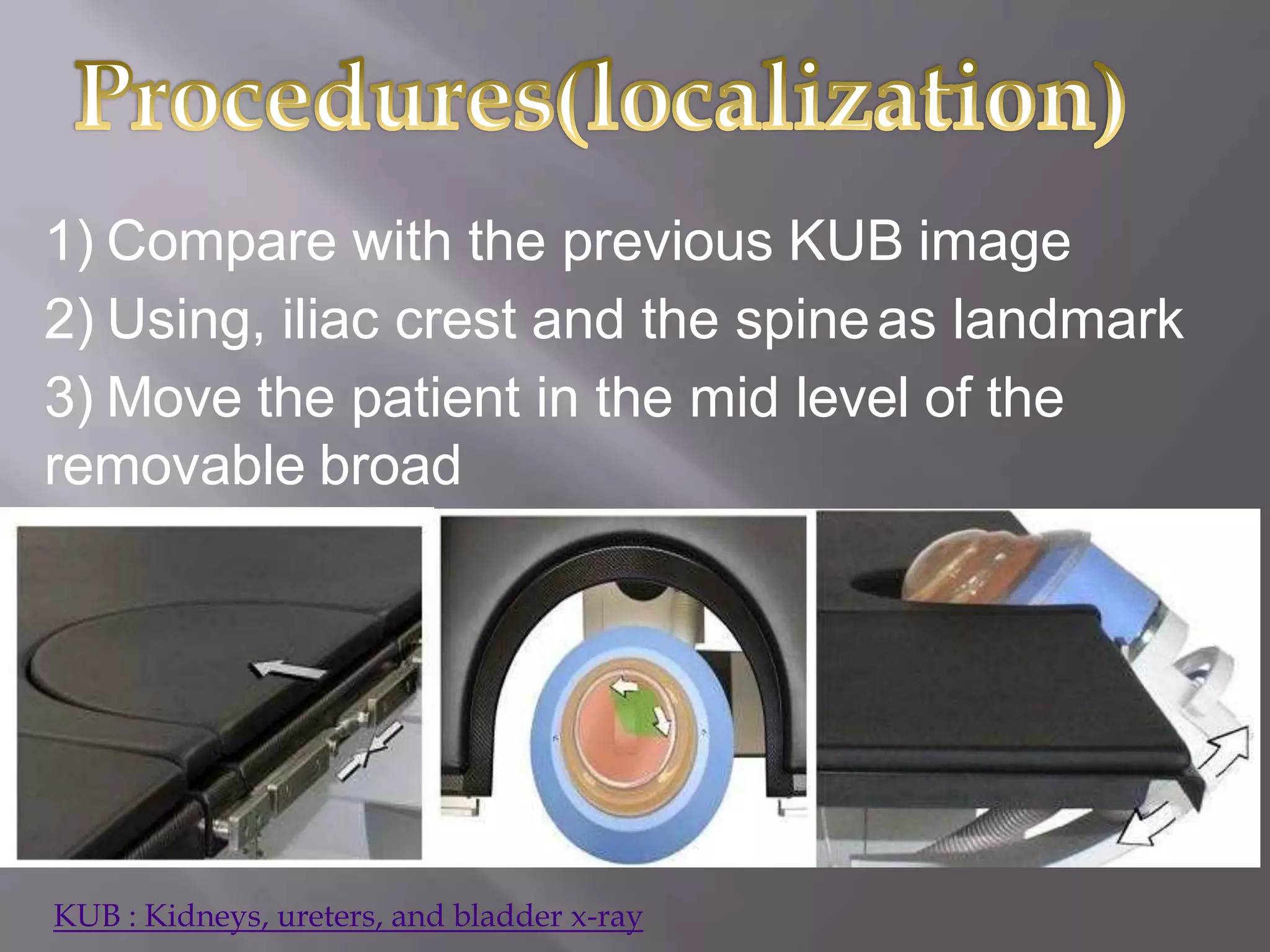 Extracorporeal shock wave lithotripsy (eswl) | PPTX