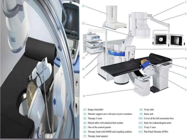 Extracorporeal shock wave lithotripsy (eswl) | PPTX