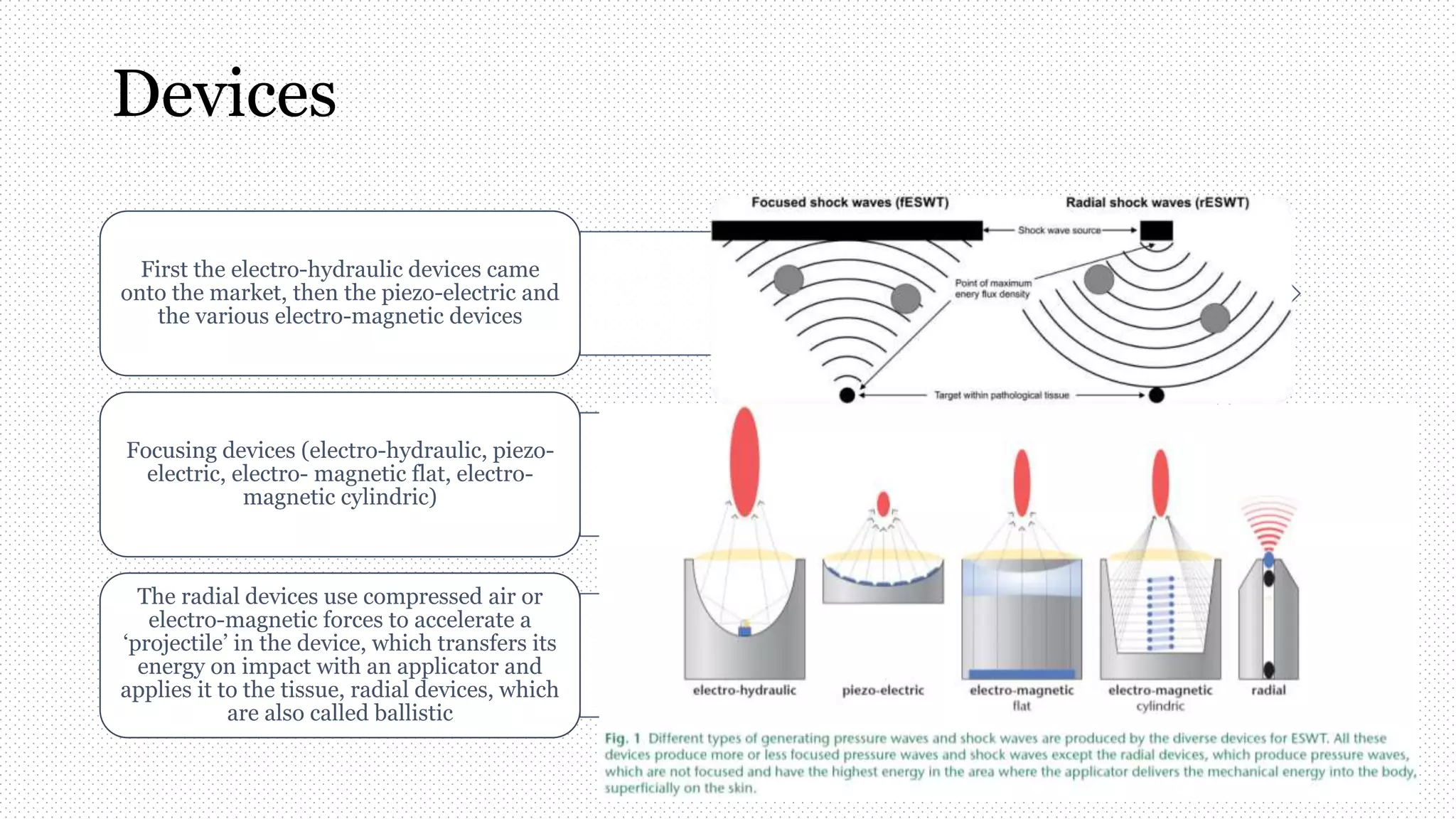 Extracorporeal shock wave therapy.pptx