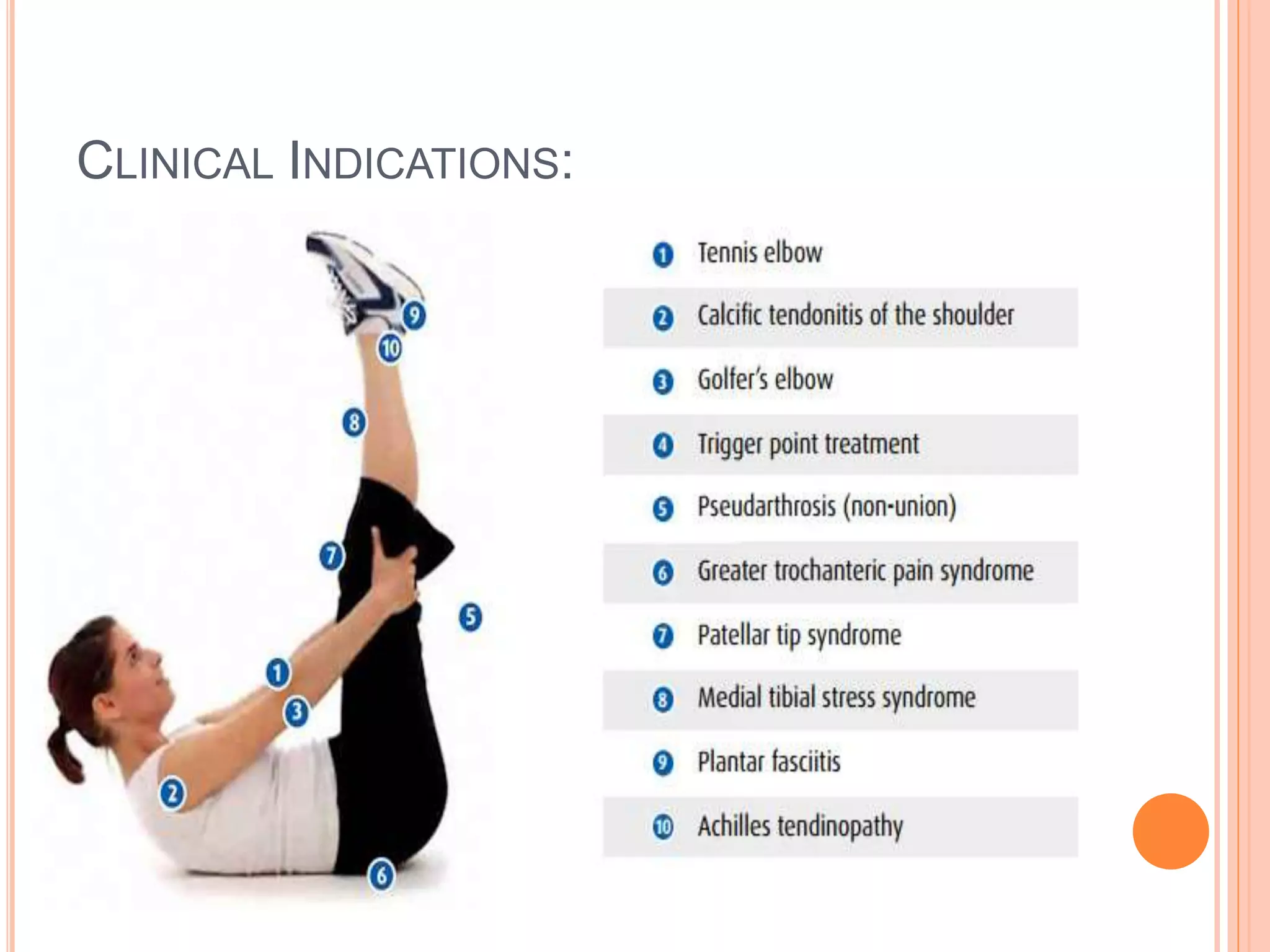 Extracorporeal shockwave therapy (eswt) | PPTX
