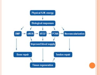 Extracorporeal shockwave therapy (eswt) | PPTX