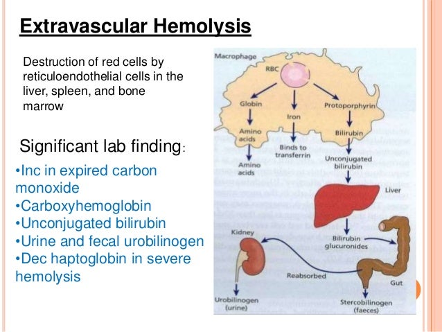 Extracorpuscular hemolytic anemia