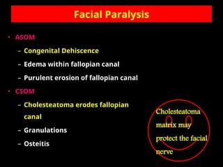 Extracranial complications of CSOM Dr. Krishna Koirala .ppt