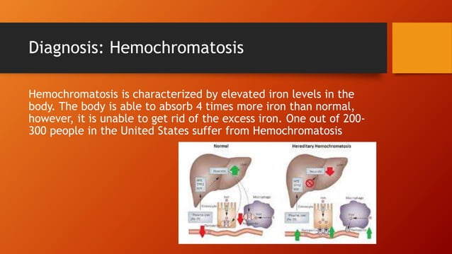 Hemochromatosis case study | PPTX