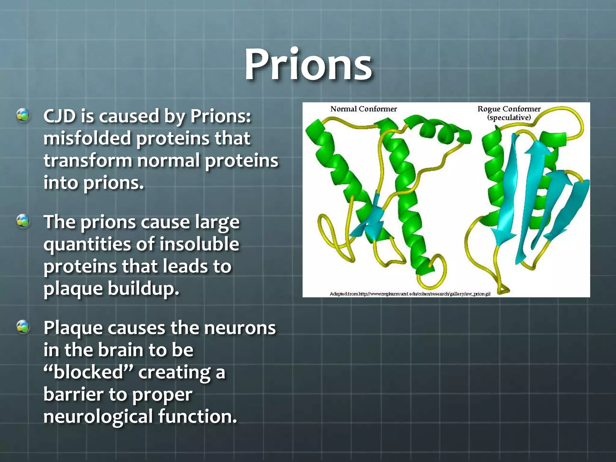 Case Study Creutzfeld-Jakob Disease | PPTX