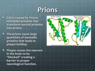 Case Study Creutzfeld-Jakob Disease | PPT