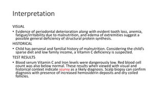 Scurvy Case Study | PPTX