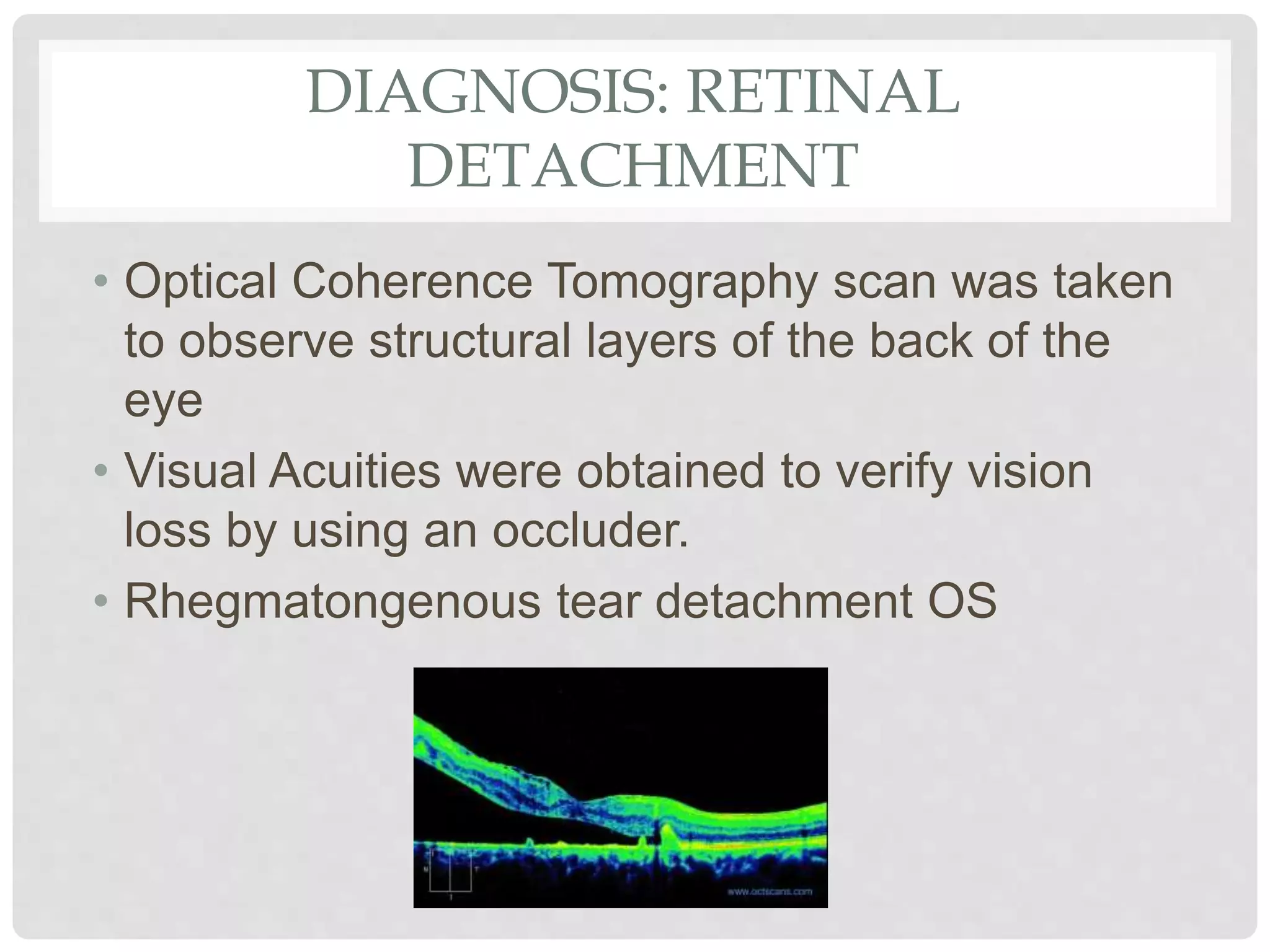 Case Study- Retina Detachment | PPTX