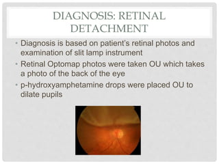 Case Study- Retina Detachment | PPTX