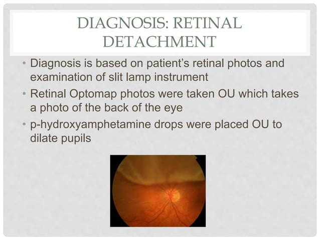 Case Study- Retina Detachment | PPTX