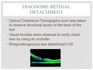 Case Study- Retina Detachment | PPTX