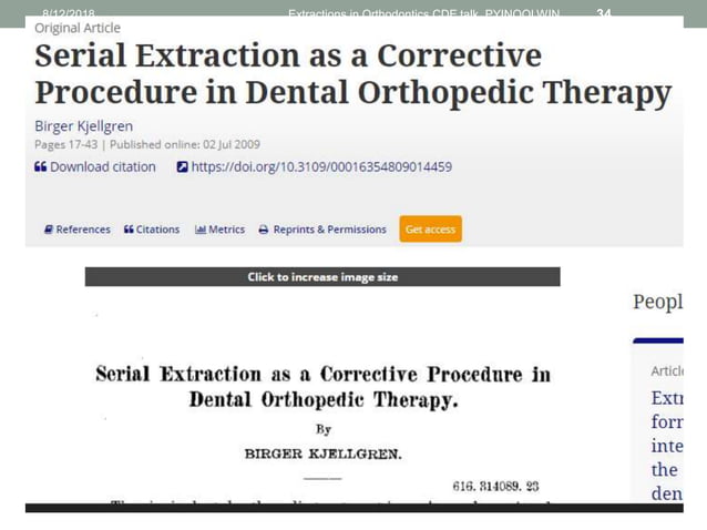 Extracrtion in orthodontics | PPT