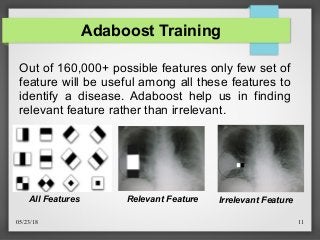 Extract Features and Classification of Diseases from X-Ray Images Using Viola-Jones Algorithm | PPT