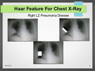 Extract Features and Classification of Diseases from X-Ray Images Using ...