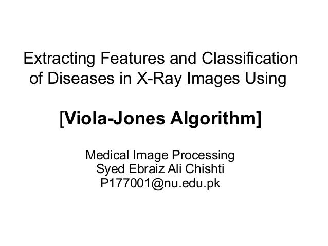 Extract Features and Classification of Diseases from X-Ray Images Using Viola-Jones Algorithm | PPT