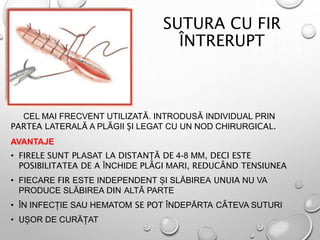 extractie-atipica....................pptx