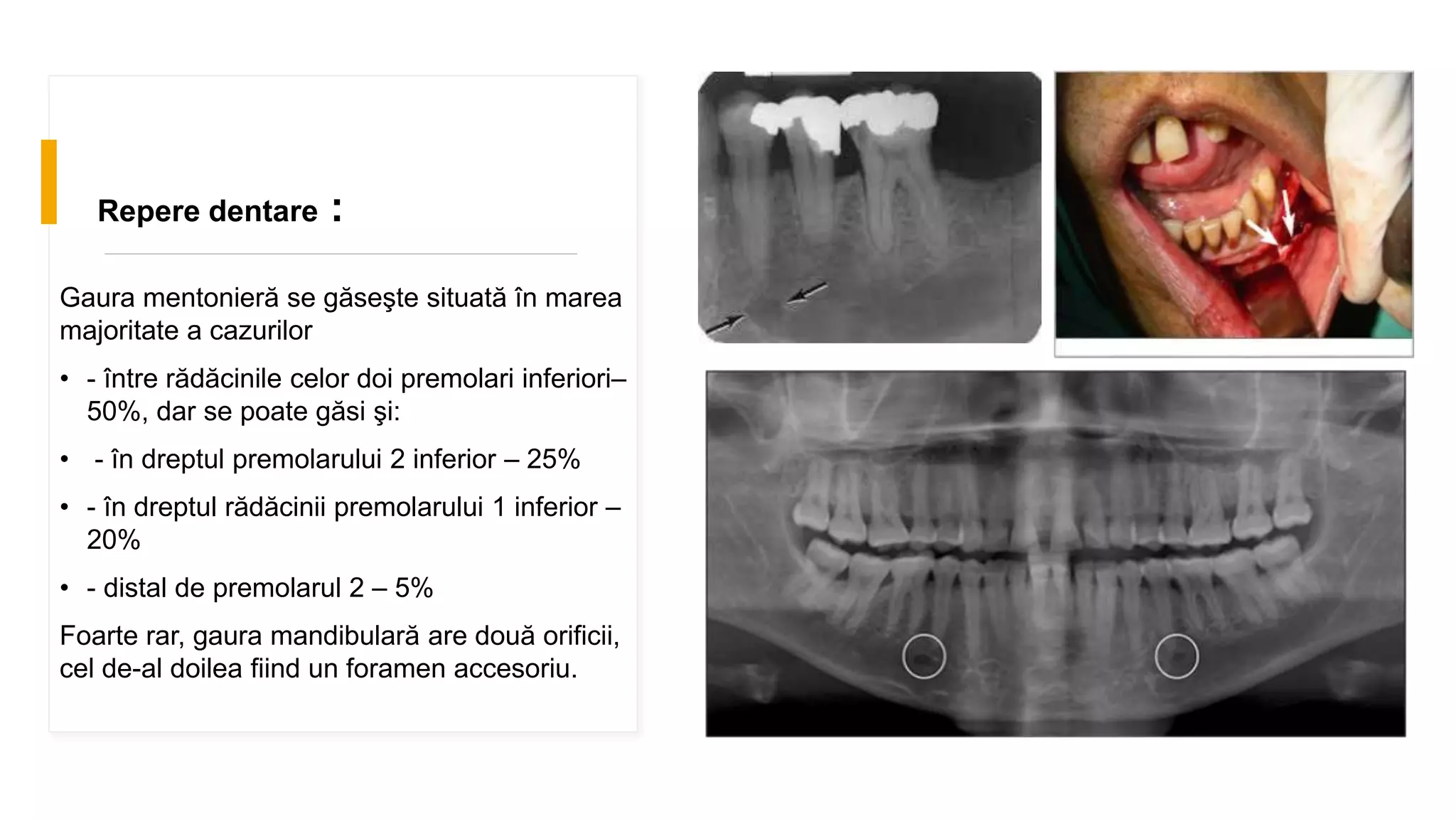 extractie 4.4.pptx